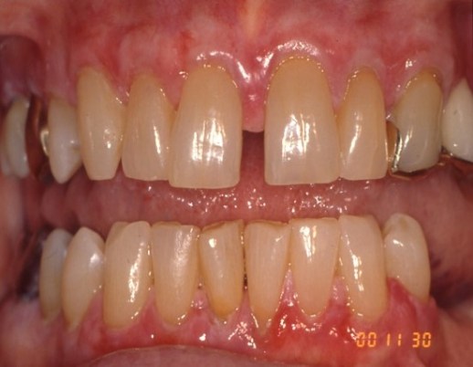 Oral Mucosal Diseases: Puzzling Conditions in Complicated Patients ...